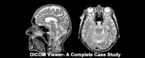 DICOM Viewer- A Complete Case Study